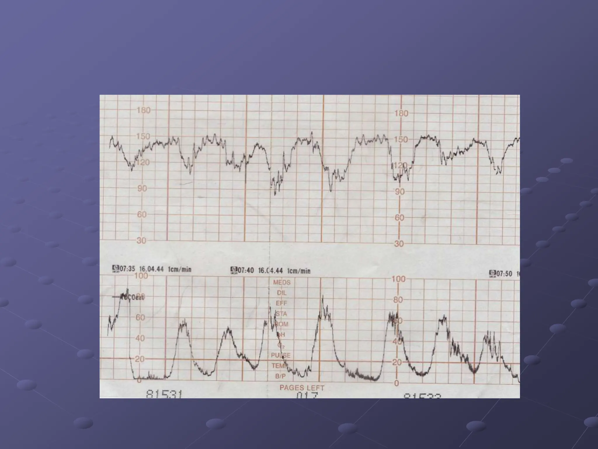 SUY THAI TRONG CHUY_N D_.ppt hay các bạn ạ | PPT