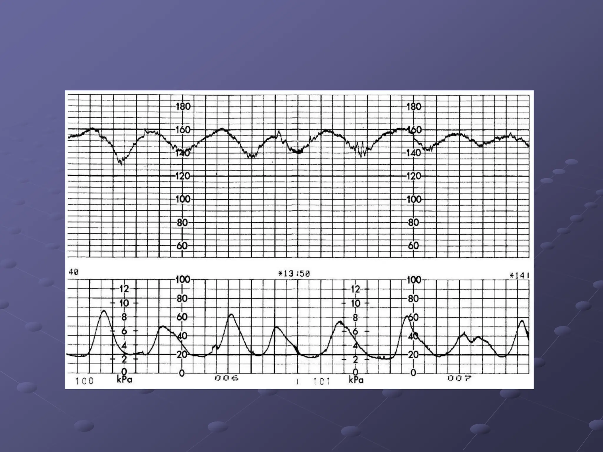 SUY THAI TRONG CHUY_N D_.ppt hay các bạn ạ | PPT