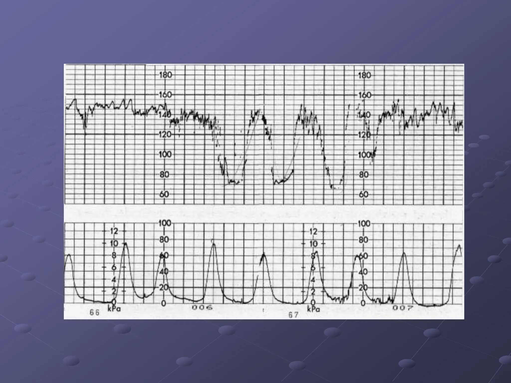 SUY THAI TRONG CHUY_N D_.ppt hay các bạn ạ | PPT