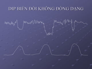 SUY THAI TRONG CHUY_N D_.ppt hay các bạn ạ | PPT