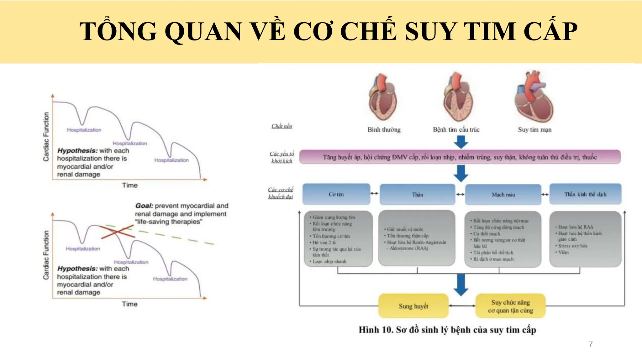 Cập nhật chẩn đoán và điều trị Suy tim cấp 2023 | PPTX