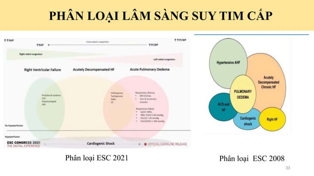 Cập nhật chẩn đoán và điều trị Suy tim cấp 2023 | PPTX