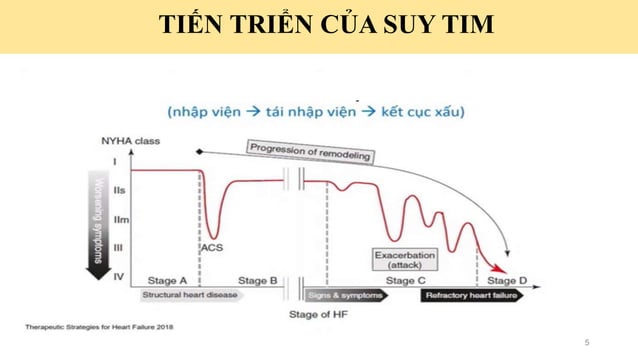 Cập nhật chẩn đoán và điều trị Suy tim cấp 2023 | PPTX