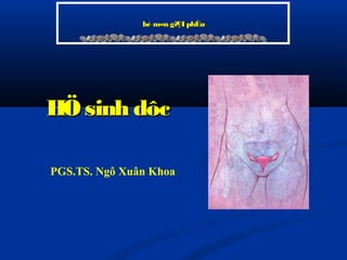 HỆ SINH DỤC | PPT