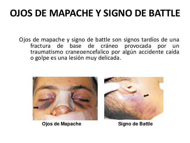 Atención pre hospitalaria en una emergencia 2013