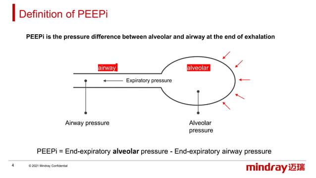 SV70 PEEPi monitoring whitepaper-EN-V1.0-20230320.pptx | Lung and ...