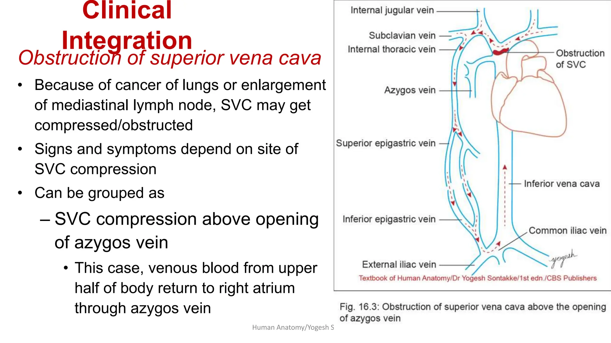 ANATOMT OF SVC & AZYGOS SYSTEM AND APPLIED ASPECTSppt | PPT