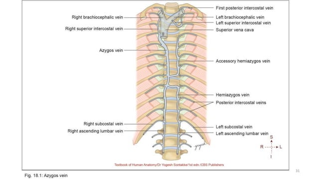 ANATOMT OF SVC & AZYGOS SYSTEM AND APPLIED ASPECTSppt | PPT | Death ...