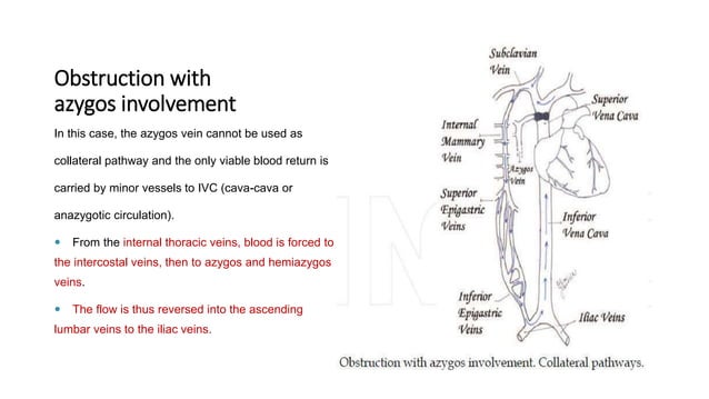 supra vena cava obstruction (SVCO) | PPTX