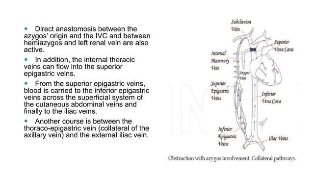 supra vena cava obstruction (SVCO) | PPTX