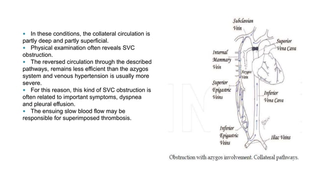 supra vena cava obstruction (SVCO) | PPTX