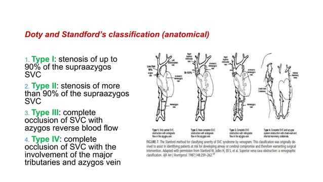 supra vena cava obstruction (SVCO) | PPTX