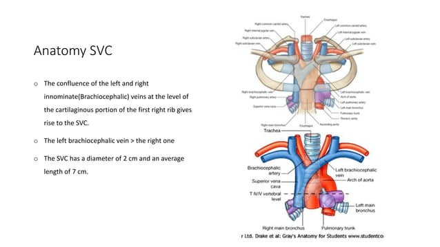 supra vena cava obstruction (SVCO)