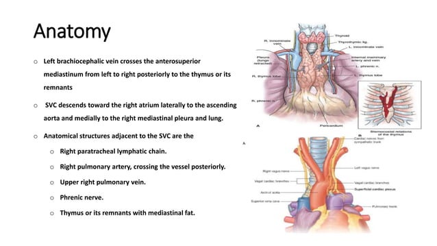 supra vena cava obstruction (SVCO)