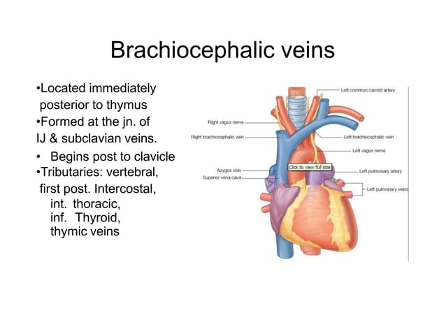 Svc syndrome, | PPT