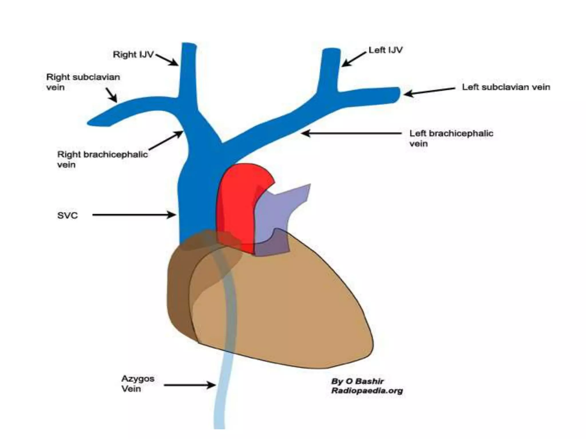 management of superior vena cava syndrome,SVCS | PPTX