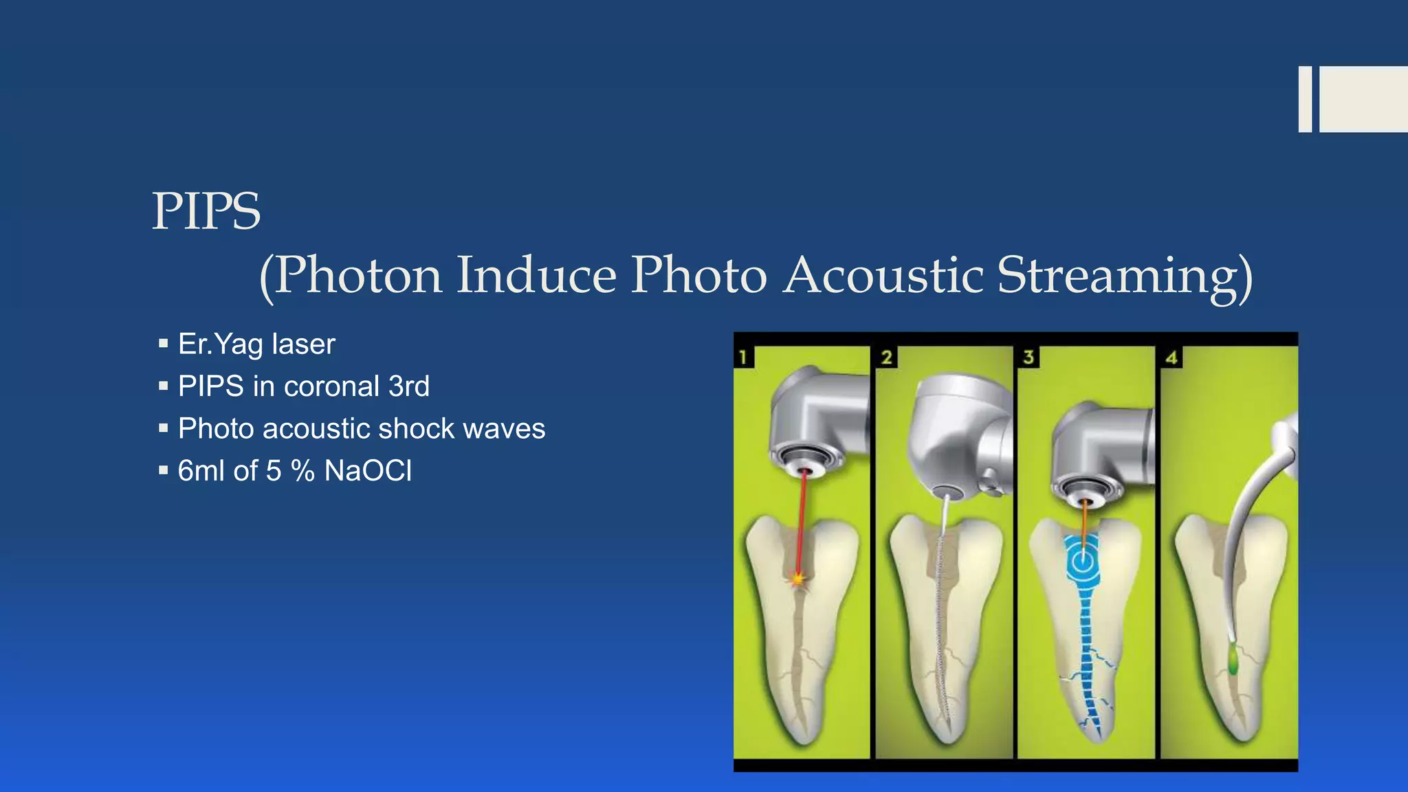 Single visit endodontics | PPTX