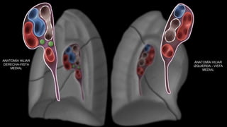Radiología_SEGMENTACION_PULMONAR_POR_TEM.pptx