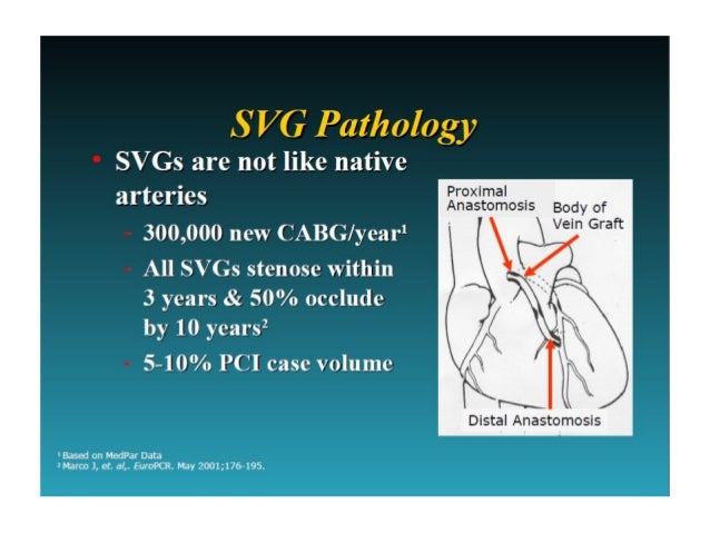 saphenou vein graft interventions