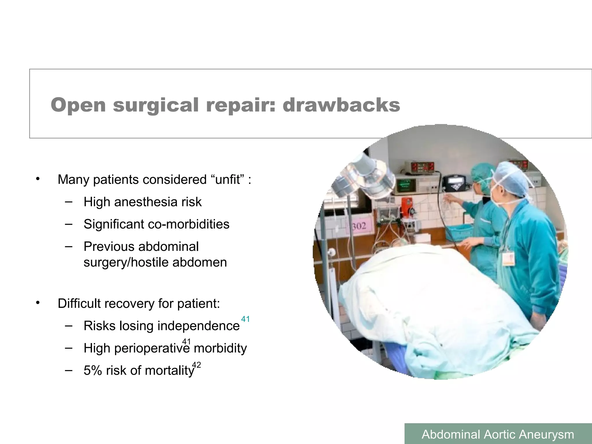 Abdominal Aortic Aneurysm | PPT