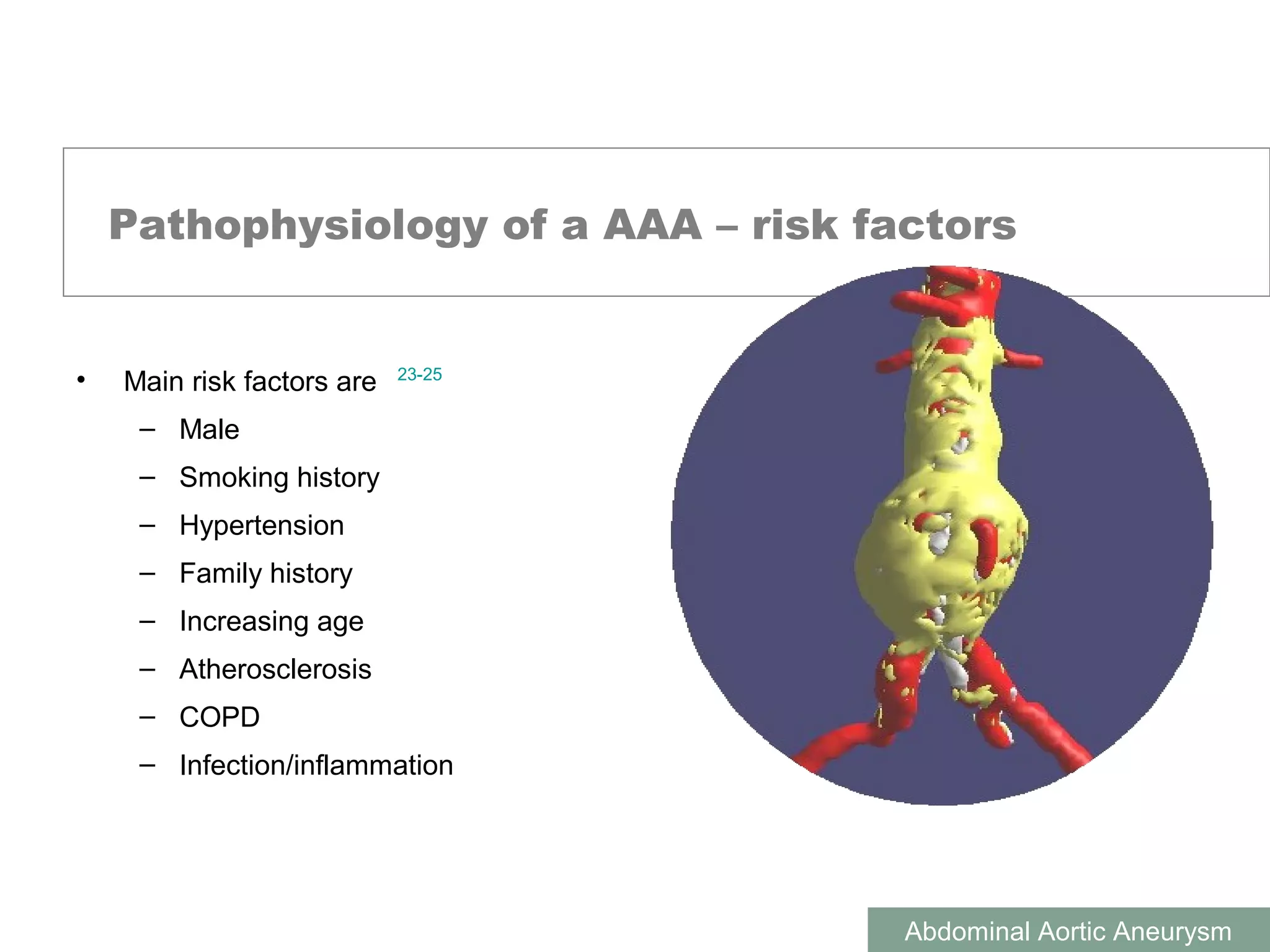 Abdominal Aortic Aneurysm | PPT