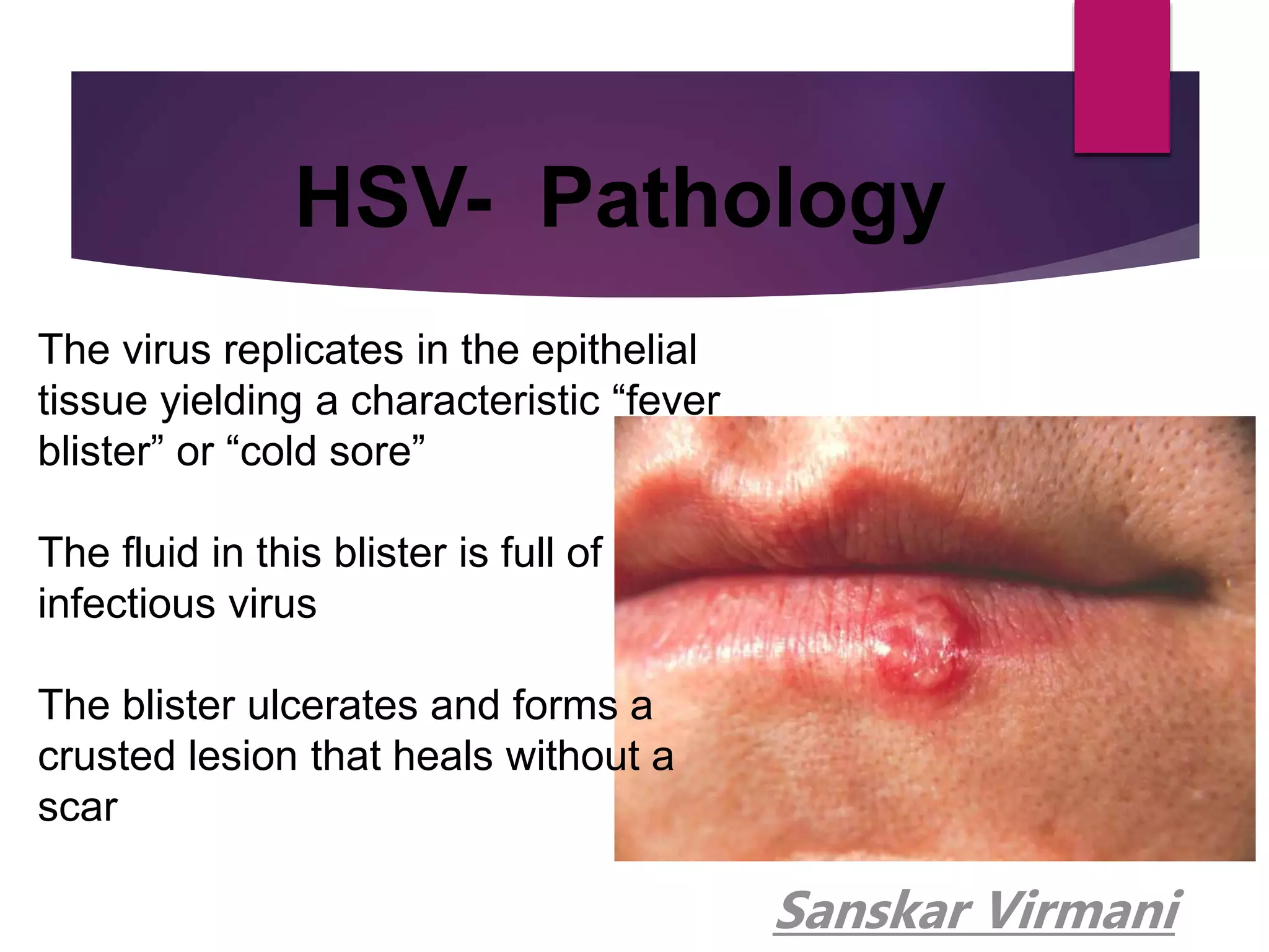 Herpesviridae Presentation | PPT