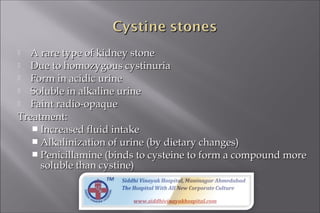 Kidney Stone Basics by Siddhivinayak Hospital Maninagar Ahmedabad | PPT