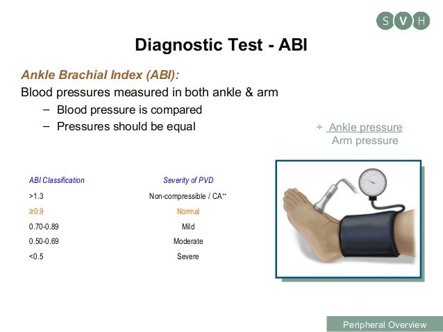 Determining a vascular cause for leg pain and referrals