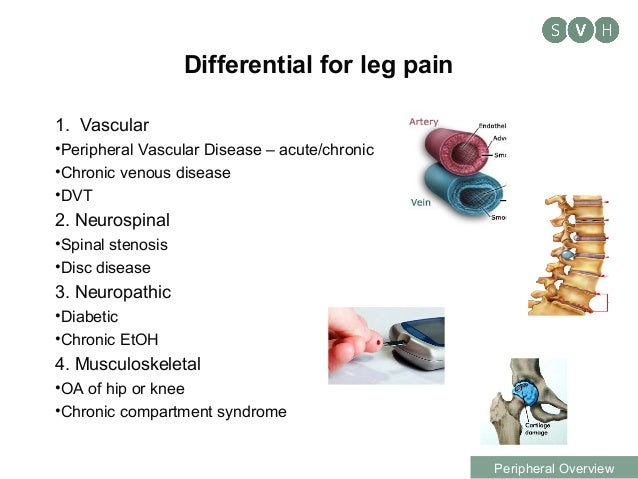 Determining a vascular cause for leg pain and referrals