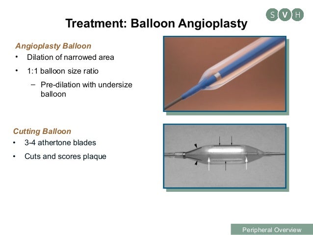 Assessment of leg ulcers and advances in endovascular treatment