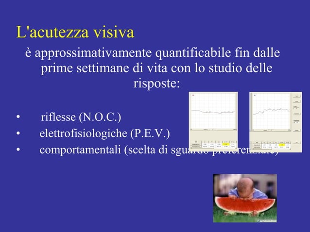Sviluppo sistema visivo | PPT