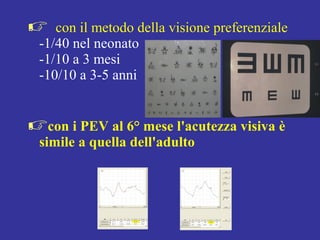 Sviluppo sistema visivo | PPT