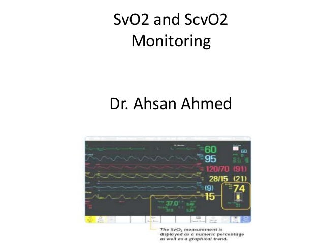 SvO2 & ScvO2 monitoring