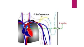 central venous pressure and intra-arterial blood pressure monitoring ...