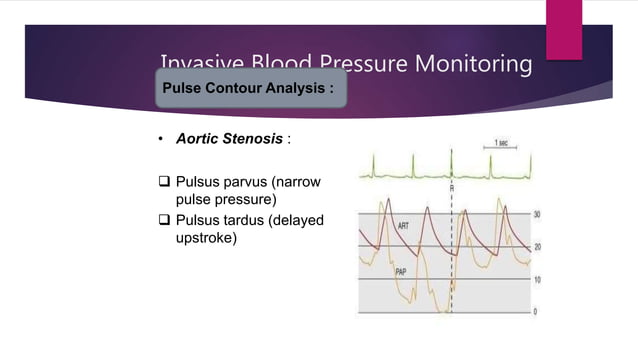 central venous pressure and intra-arterial blood pressure monitoring ...