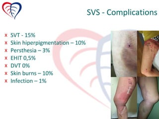 Steam Vein Ablation is safe and efficacious | PPT