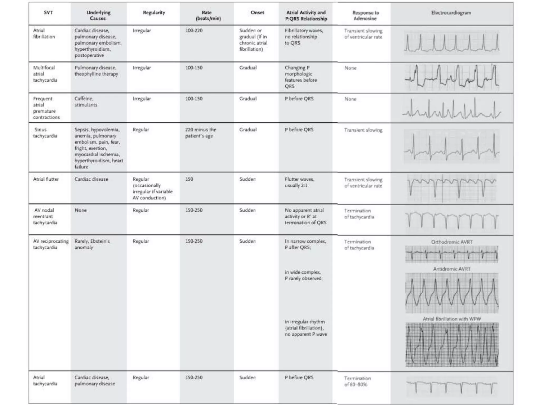 Evaluation and Initial Treatment of Supraventricular Tachycardia | PPTX