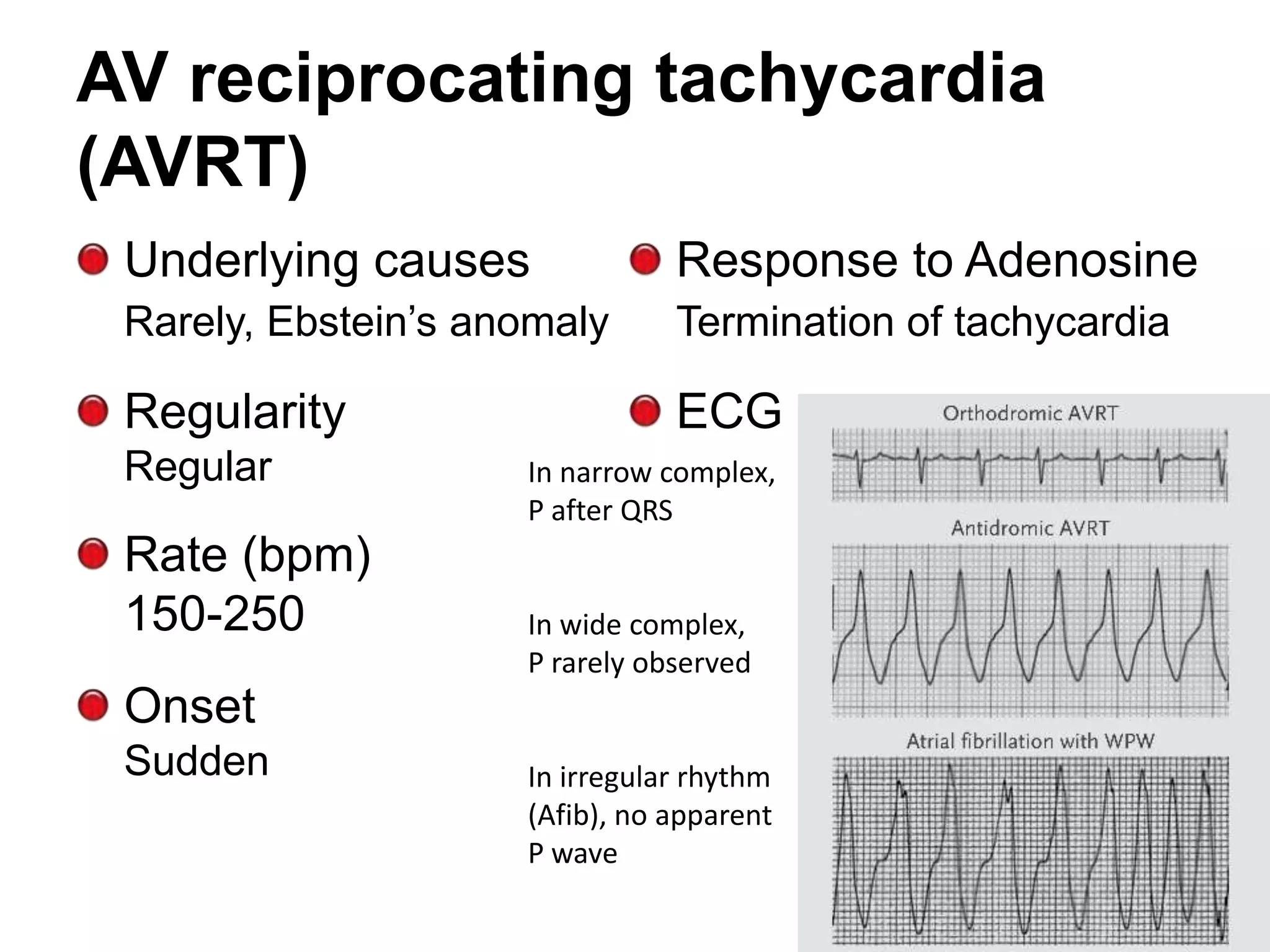 Evaluation and Initial Treatment of Supraventricular Tachycardia | PPTX