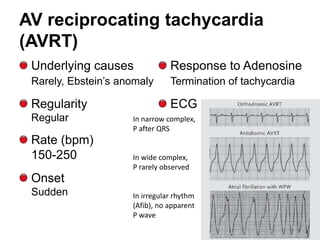 Evaluation and Initial Treatment of Supraventricular Tachycardia | PPTX