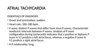 Supraventricular Tachycardia (SVT) Presentation | PPTX