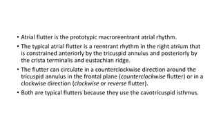 SUPRAVENTRICULAR TACHYCARDIA - SVT | PPTX
