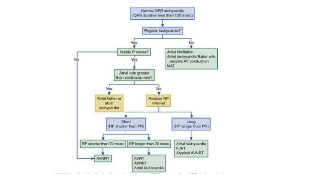SUPRAVENTRICULAR TACHYCARDIA - SVT