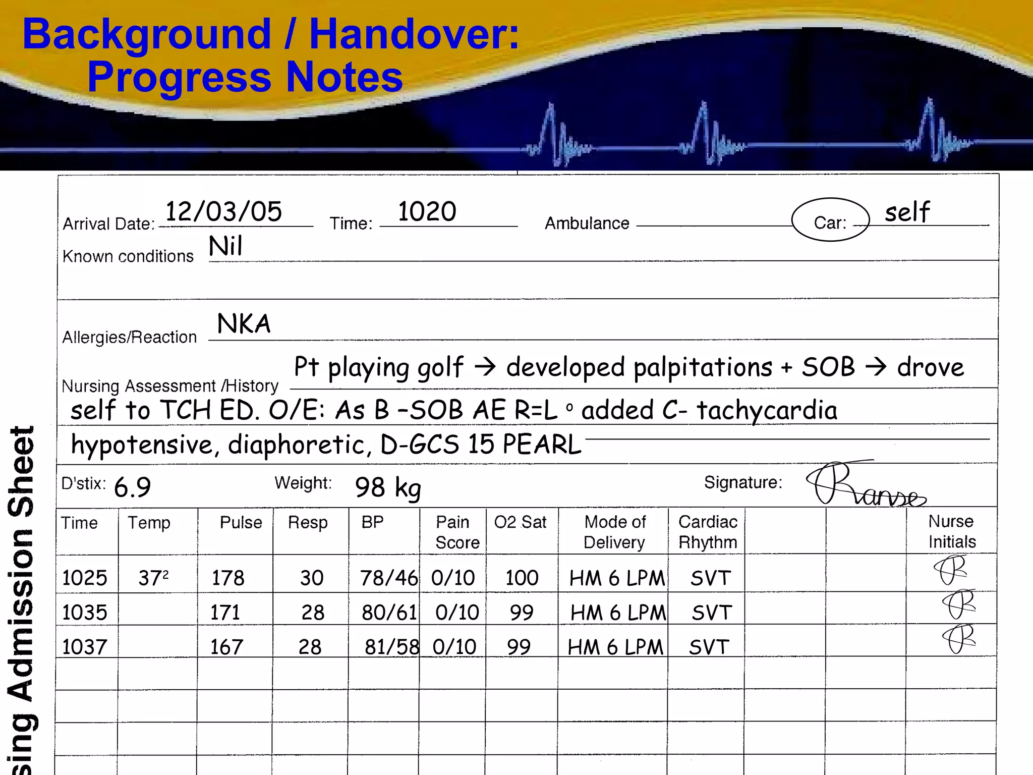 The ECG as a Diagnostic Tool: A Clinical Case Study of Supraventricular ...