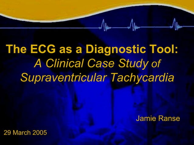 The ECG as a Diagnostic Tool: A Clinical Case Study of Supraventricular ...