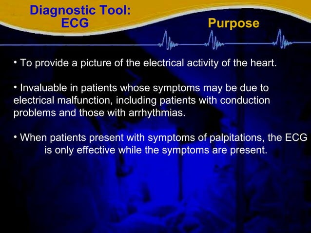 The ECG as a Diagnostic Tool: A Clinical Case Study of Supraventricular Tachycardia | PPT