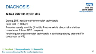SVT presentation in children with ecg pictures | PPT