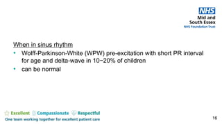 SVT presentation in children with ecg pictures | PPT