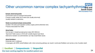 SVT presentation in children with ecg pictures | PPTX