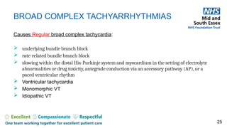 SVT presentation in children with ecg pictures | PPTX