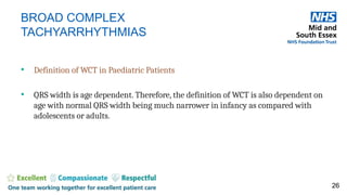 SVT presentation in children with ecg pictures | PPTX
